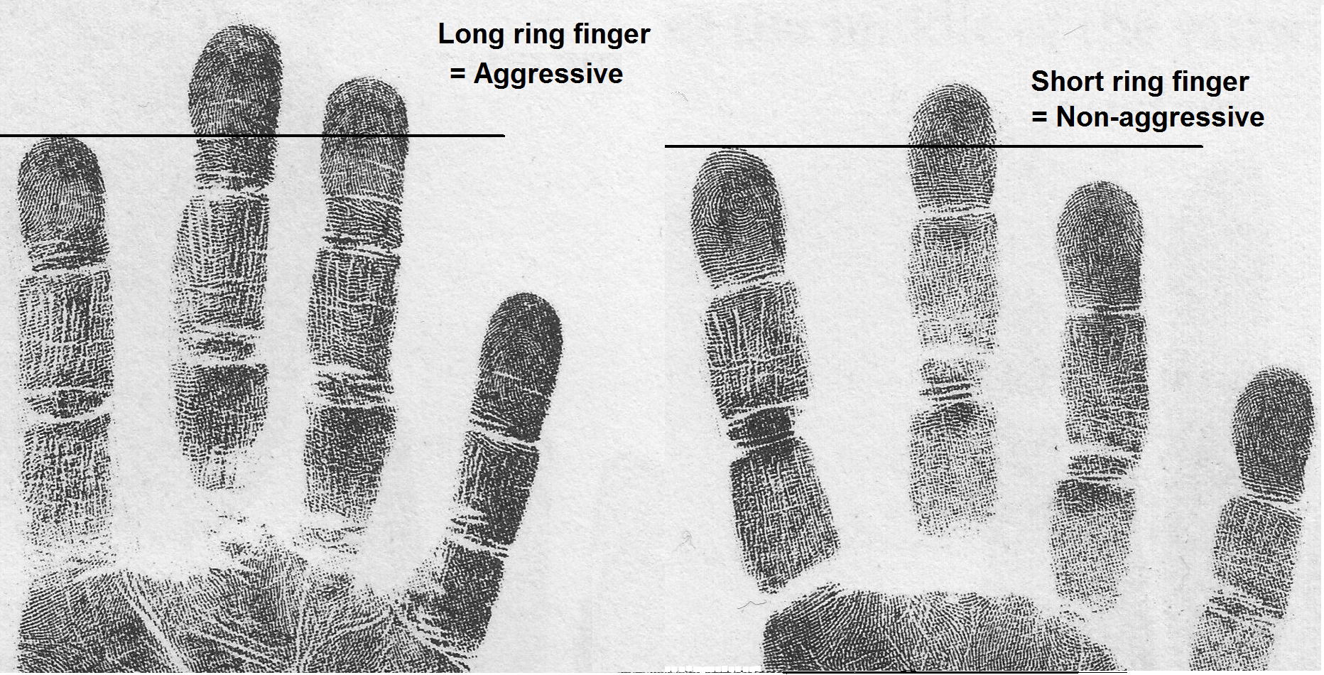 Length of ring finger predicts physical aggression in men – NAVAMSA